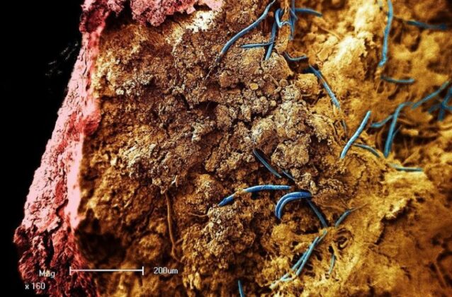 NEXT STORY INNER EARTH IS TEEMING WITH LIFE: MULTICELLULAR ANIMALS ...